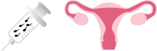 Tipos de Inseminación Artificial, Precios y Tasa de Éxito | GUIA 2023